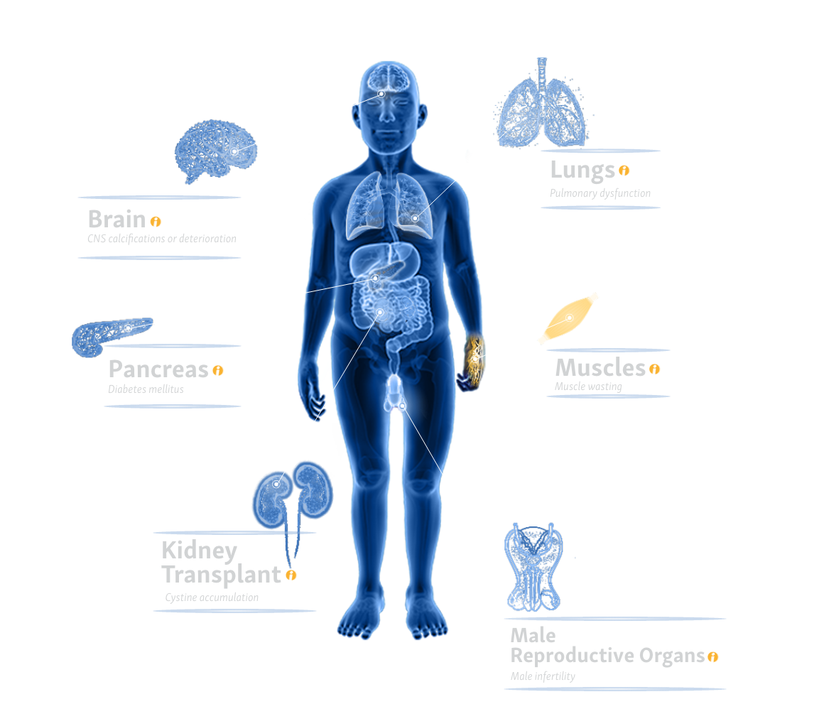 Cystinosis Prognosis and Adherence | For HCPs